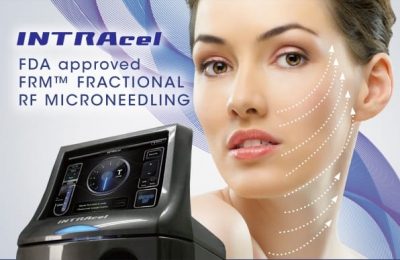 NEW – INTRAcel Fractional RF Microneedling Treatment – Institut Dermed